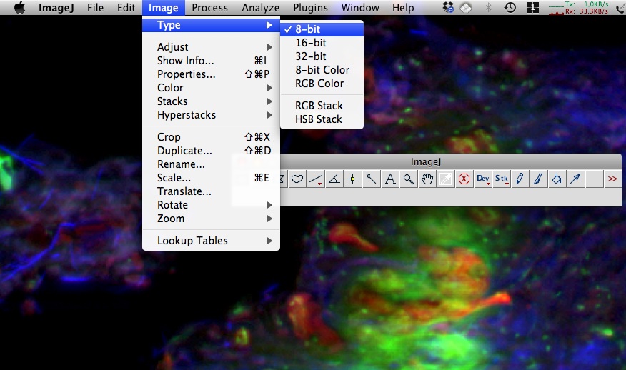 Fiji imagej plugin color deconvolution - frosdab